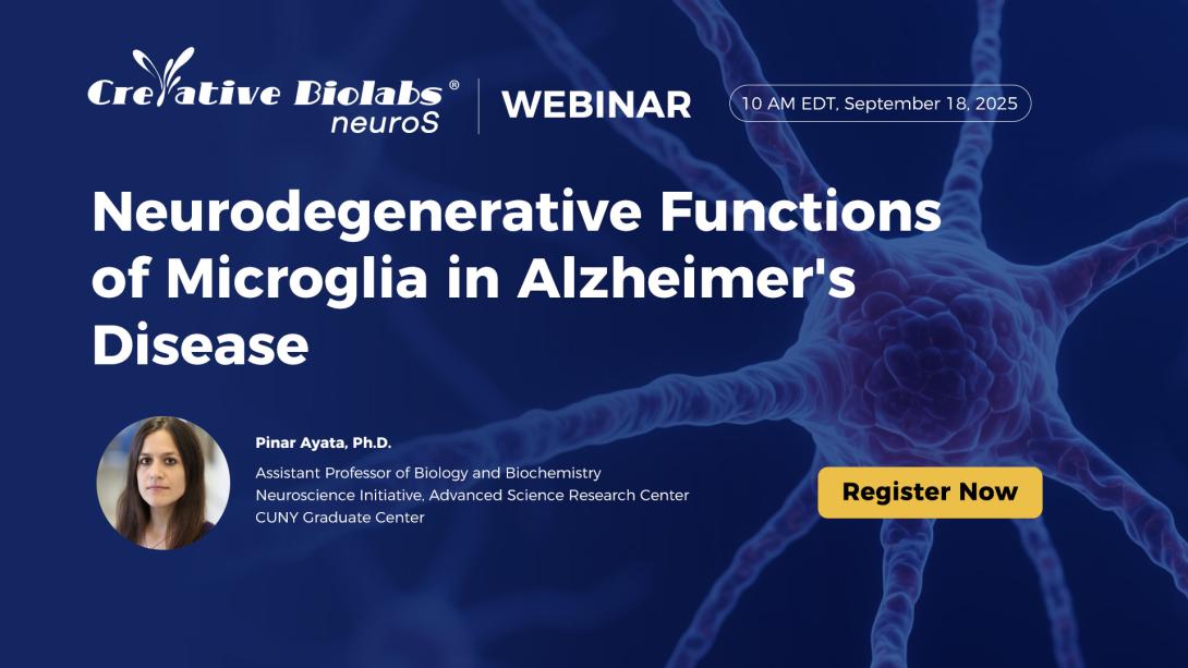 Neurodegenerative Functions of Microglia in Alzheimer's Disease ...